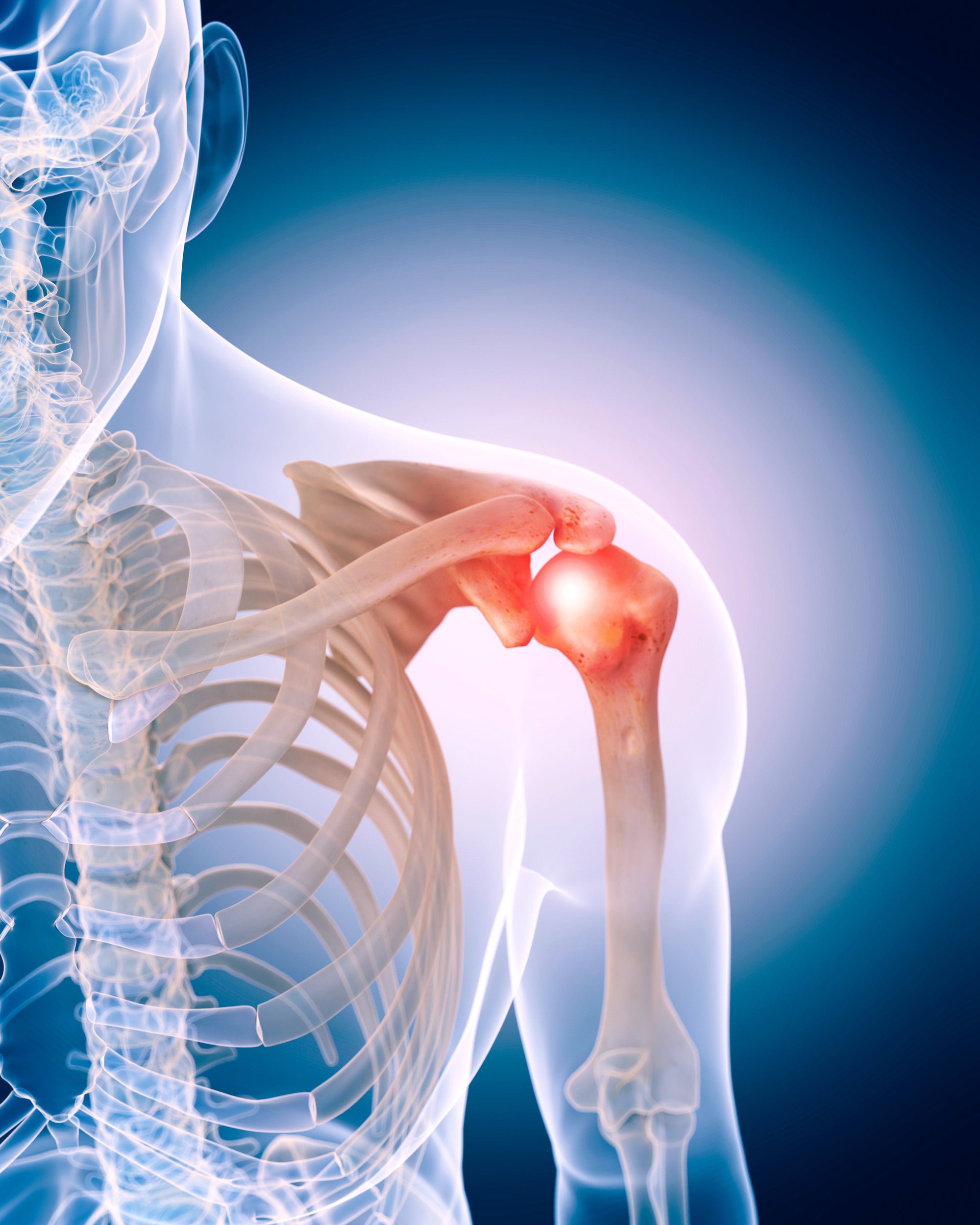 How Standing Desks Can Help With Anterior Shoulder Pain